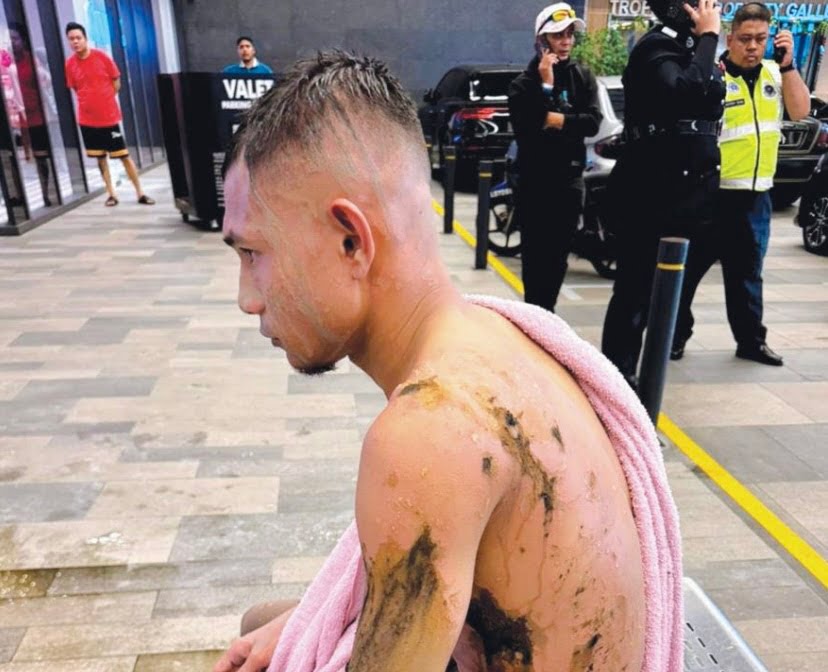 Polis siasat motif dua individu simbah asid pada Faisal Halim | Warta ...